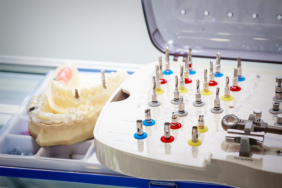 Fusion Dental Implant Club